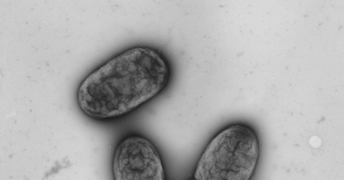 Das ist die Pest: Wie der Erreger gefährlich wurde | Nachrichten aus ...