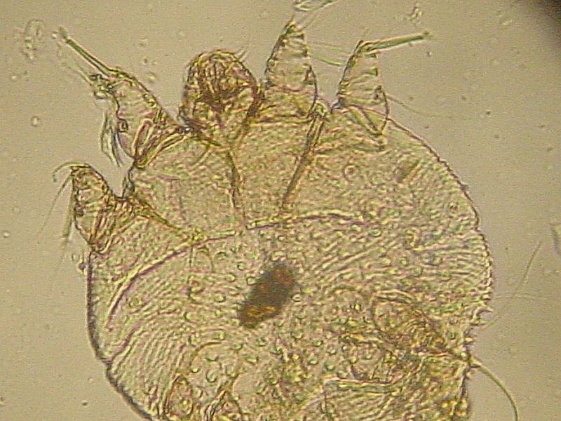 Große Krätzebehandlung in Lemgo begonnen | Lokale Nachrichten aus Lemgo ...