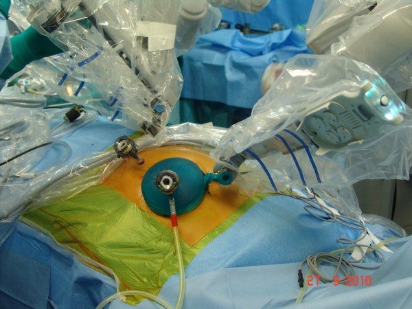 Komplizierte Bauch-OPs in Kliniken unterschiedlich gut | Nachrichten ...