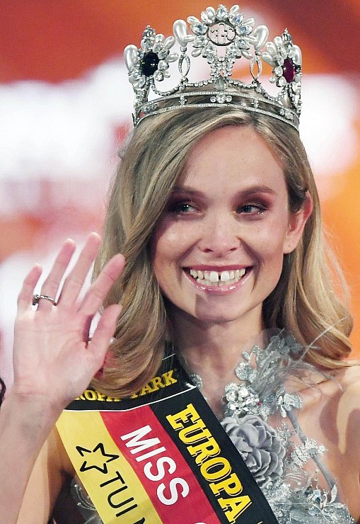 Nadine Berneis bekommt Lob für ihre Zahnlücke | Neues aus dem Boulevard ...